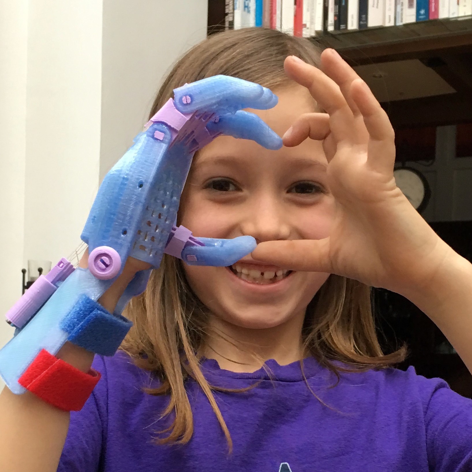 E-Nable – Le Comptoir des Solutions